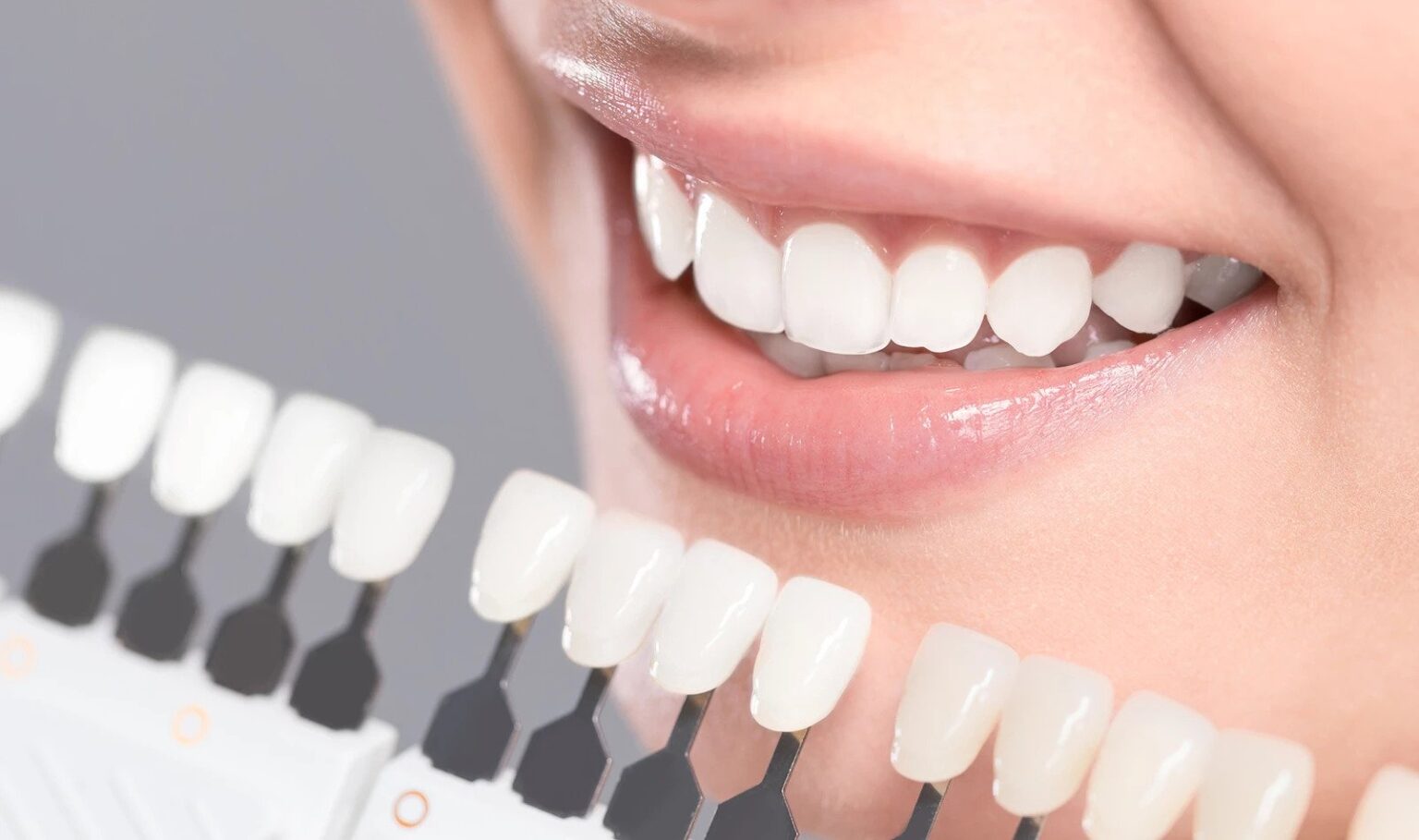 How To Get Bright White Teeth Fast At GM Dental Rochester Kent - Barnet ...