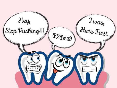 Crowding Teeth - Barnet (London) Ashford & Rochester (Kent) - GM Dental