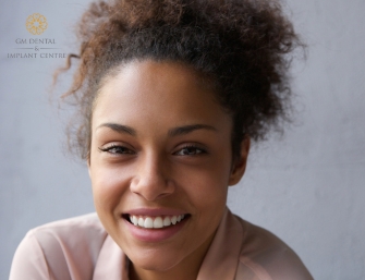 How Does Composite Bonding Work? A Simple Guide - Barnet (London ...